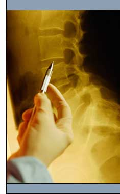The Gonstead Technique | Forest Lake Chiropractic